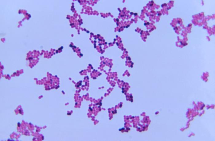 Coloracao De Gram De Acinetobacter Baumannii