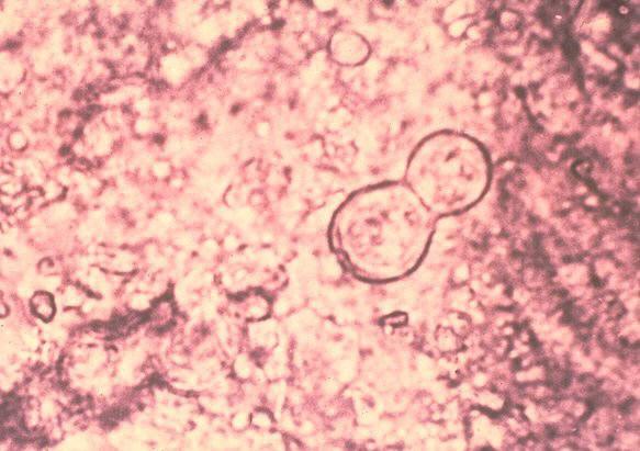 blastomycosis structure