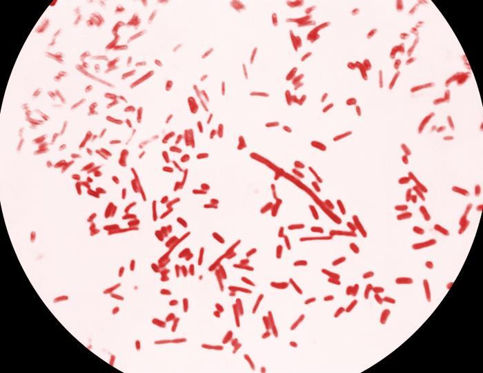 shigella