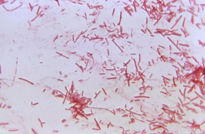 shigella