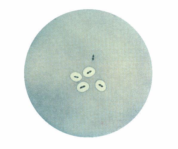 streptococcus capsule