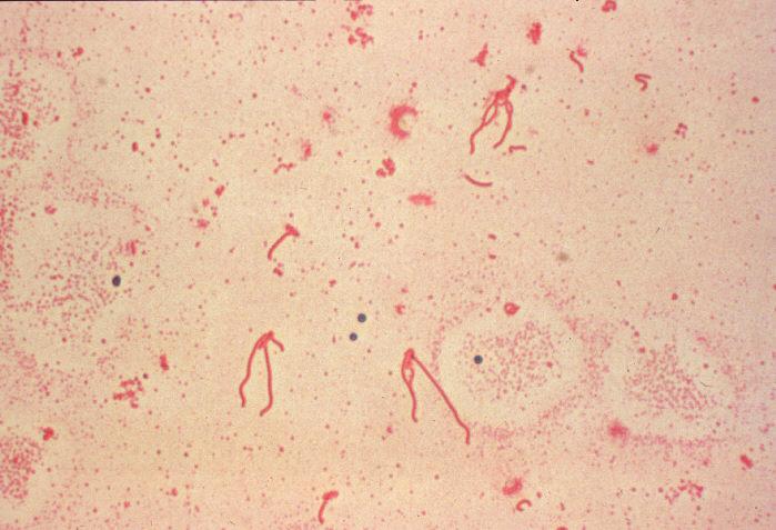 yersinia identification