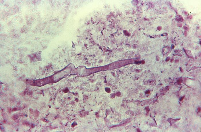 zygomycetes microscope