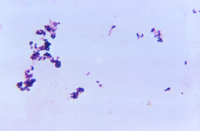 corynebacterium nhs
