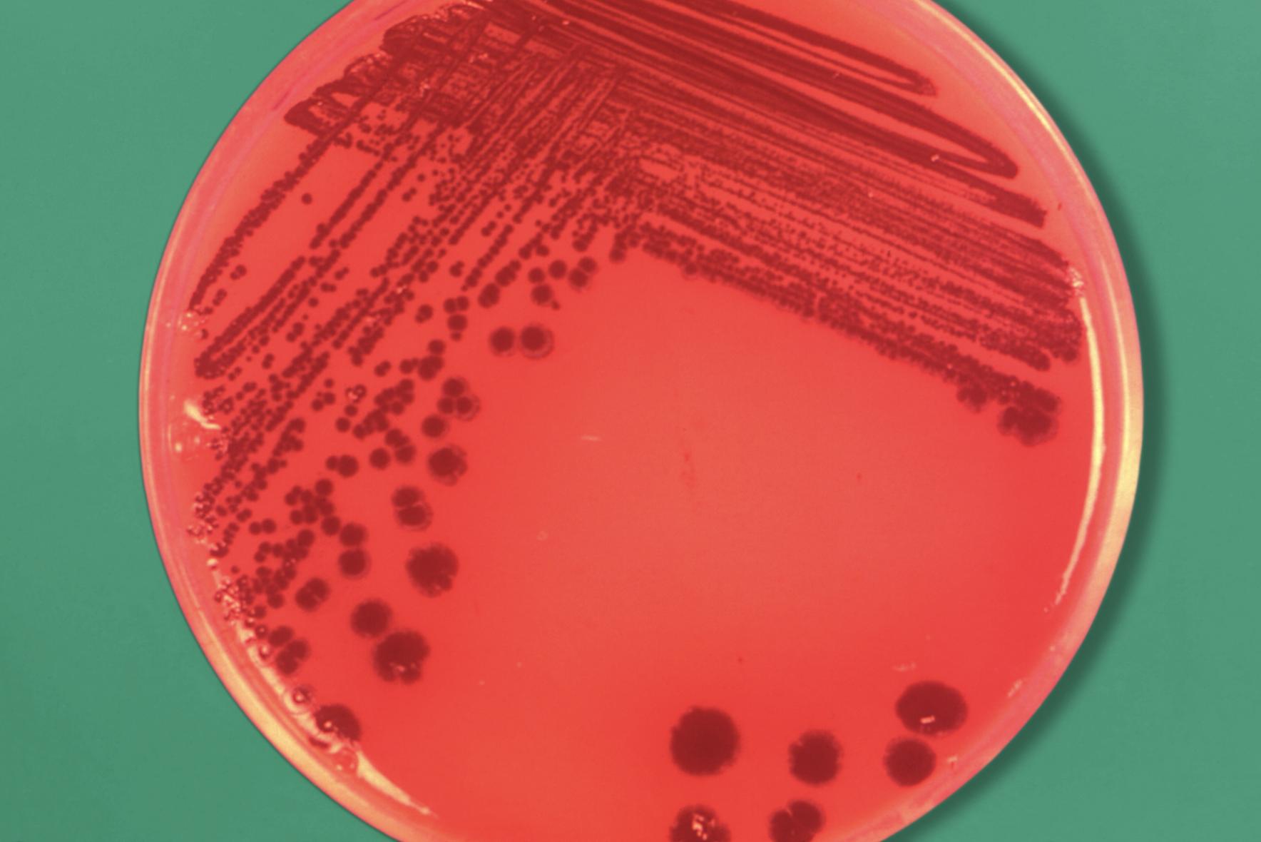 What Is Prevotella Bivia What Does Prevotella Bivia Mean More Easily