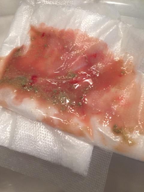 actinomyces colonisation