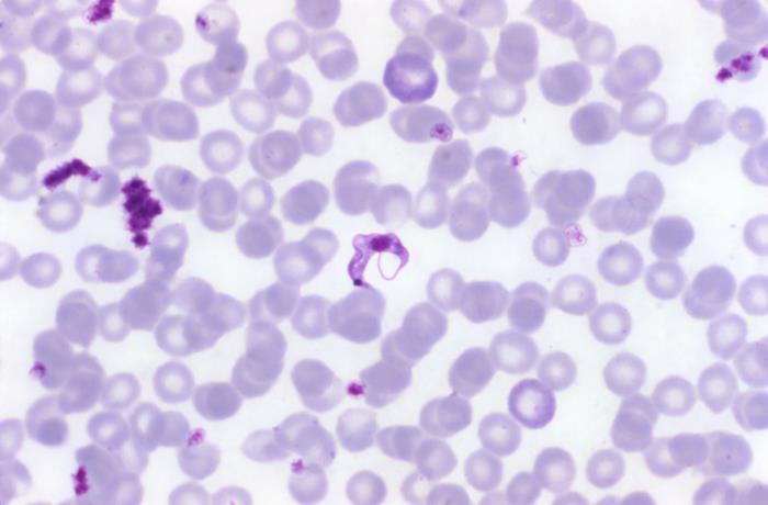trypanosoma gambiense 1000x