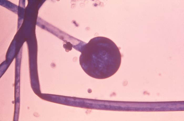 zygomycetes microscope