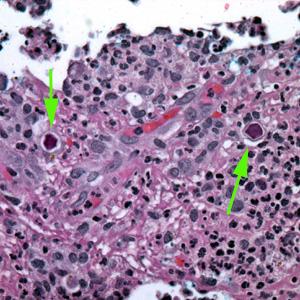 acanthamoeba cyst under microscope