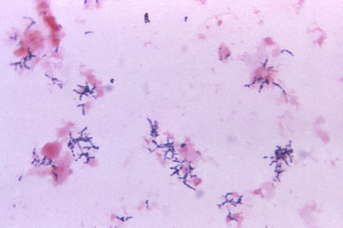 actinomyces colonisation