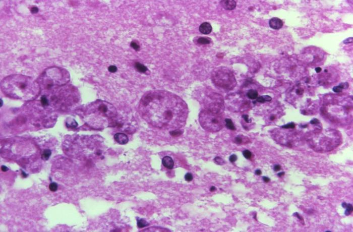 acanthamoeba cyst microscopy